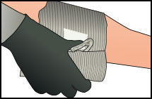 Circulation: Controlling Bleeding