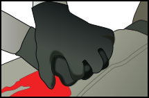 Circulation: Controlling Bleeding